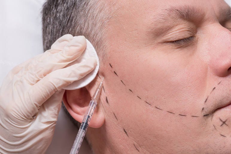 How Does a Beard Transplant Work? | by Raneem Mustafa | Medium