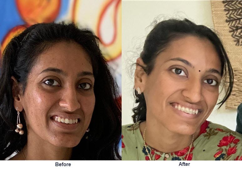 One Hundred days on Raw Diet. “Are you Crazy”? is what some people… | by Ishu Agarwal | Medium