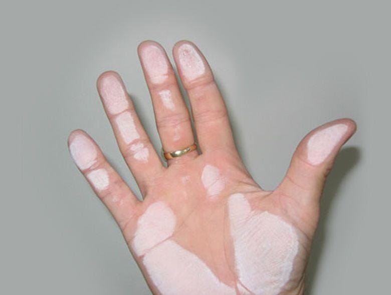 Why there are chalking when touching the wall? | by Julia Momoka | Medium
