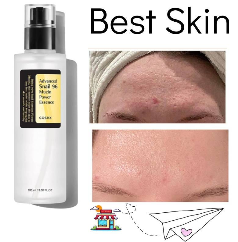 Best Skin Cosrx Advanced Snail 96 Mucin Power Essence | by Noelle ...