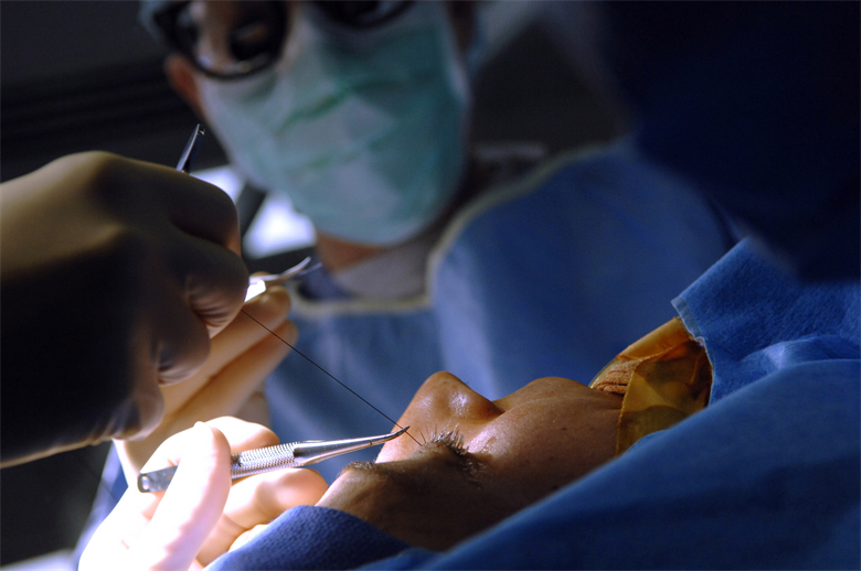 Why Choose an Oculoplastic Surgeon? | by VisionEyeCenter | Medium