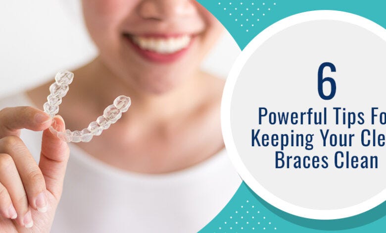 6 Powerful Tips For Keeping Your Clear Braces Clean - Chatfield Dental ...