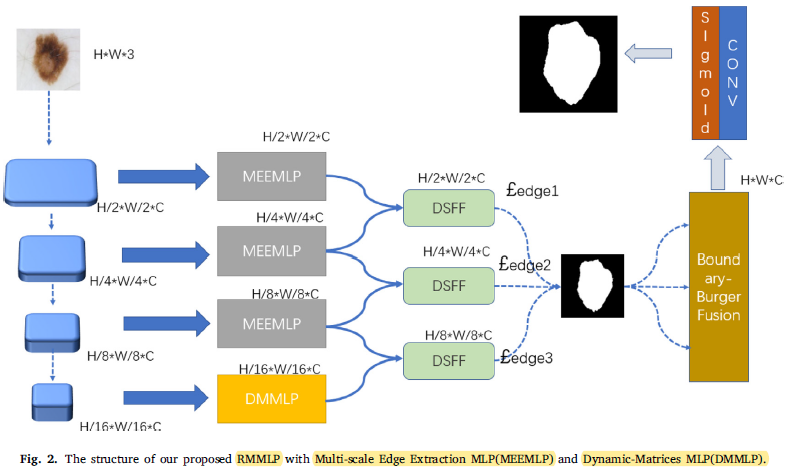 Review — Rmmlp Rollingmlp And Matrix Decomposition For Skin Lesion Segmentation By Sik Ho
