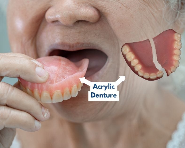 The Truth About Acrylic Dentures: Why a Permanent Solution Could Save ...