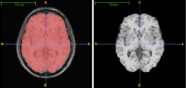 Preprocessing MRI in Python. There are a couple of tricks that I've ...