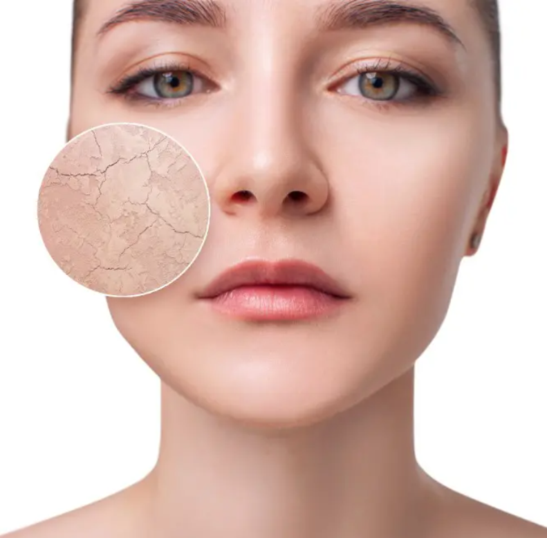 How To Make Dry Winter Skin Last Year’s Problem | by Bombshell Whims ...