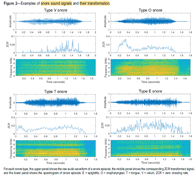 Brief Review — Automatic Classification Of Excitation Location Of