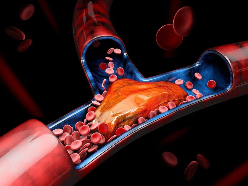 Understanding the Benefits of Vasodilation Protocol for Optimal Health ...