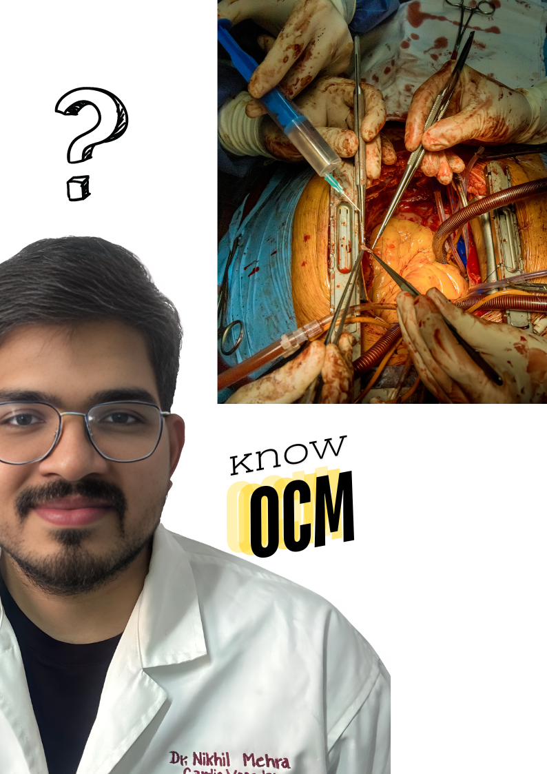 Open cardiac massage!. Keeping the Spark Alive: Open Cardiac… | by Dr ...