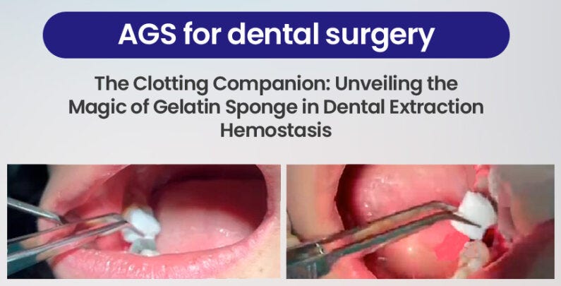 AGS for dental surgery: The Clotting Companion: Unveiling the Magic of ...