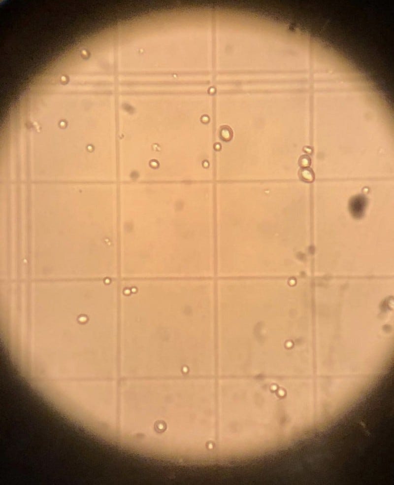 Torulaspora delbrueckii Yeast and Stuff About It | by Dave Bleitner ...