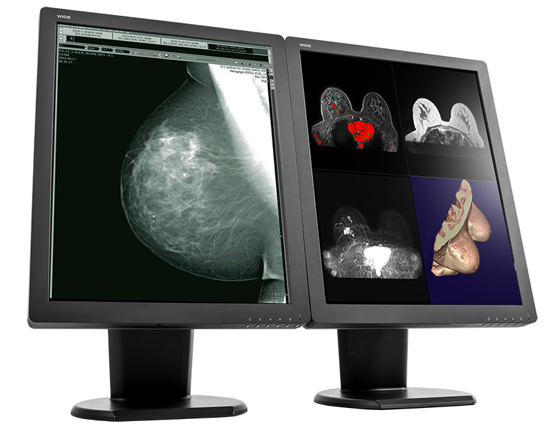 Radiology Display Monitors: Enhancing Diagnostic Accuracy | by ...
