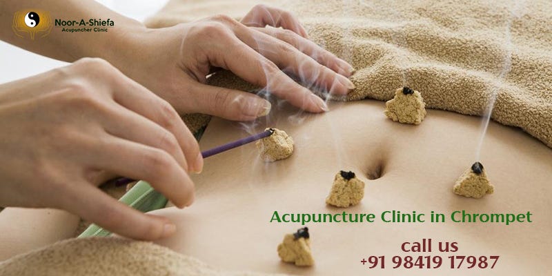 Acupuncture Clinic in Chrompet. Acupuncture Clinic in Chrompet work on ...