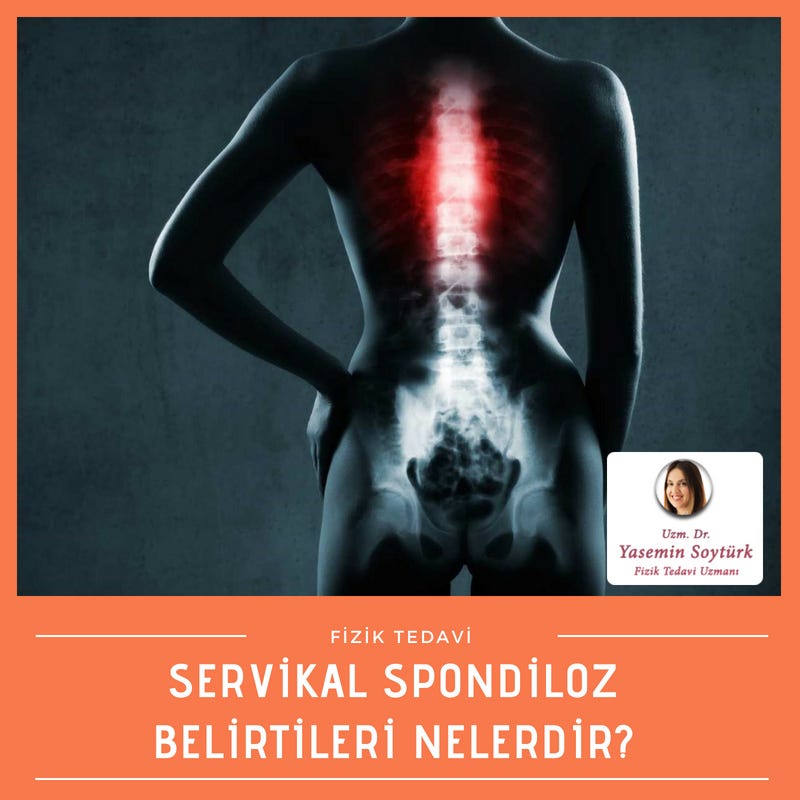 Servikal spondiloz tipik olarak boynu etkiler, ağrı ve tutulmaya neden ...