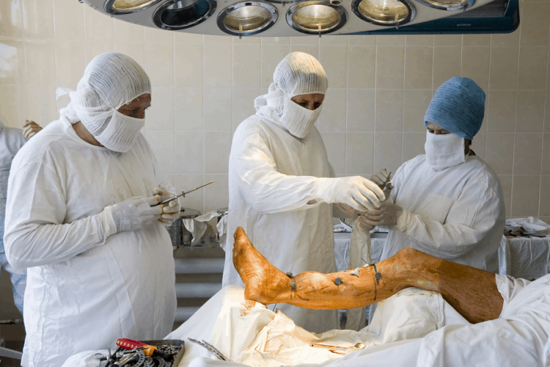Orthopedic Surgeon- 6 Interesting Facts Before Choosing One | by Siora ...