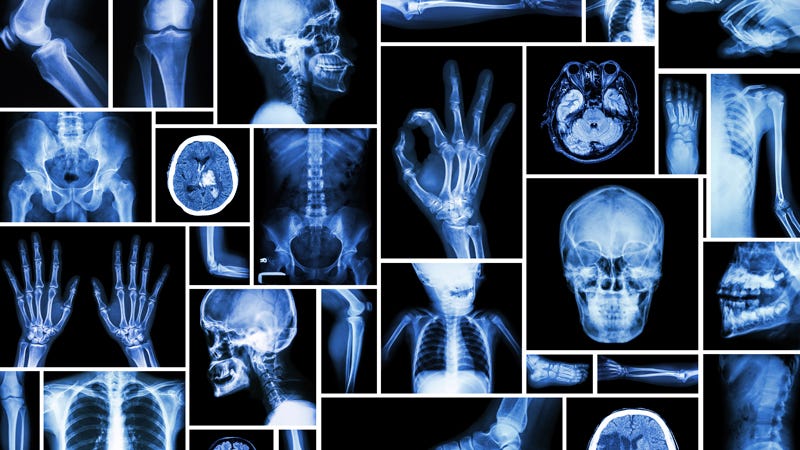 Upcoming Global Radio imaging Trends of 2020 | by Vesta Teleradiology ...
