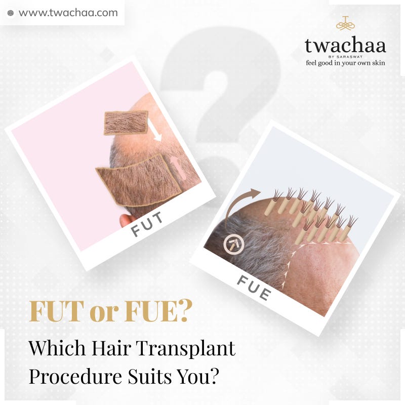 FUT or FUE? Which Procedure is the Best for You? | by Twachaa By ...
