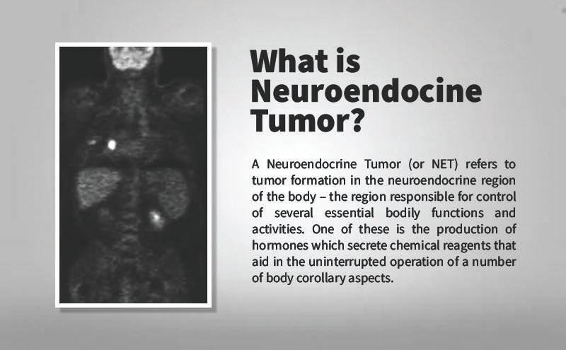 All you need to know about Neuroendocine Tumor | Medium