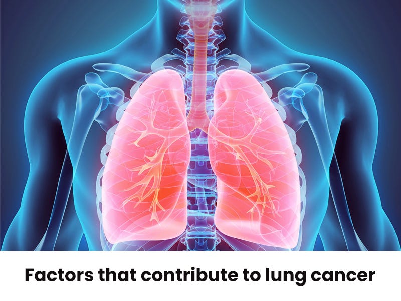 Factors That Contribute To Lung Cancer By Apurba Digitalgoogly Feb 2024 Medium