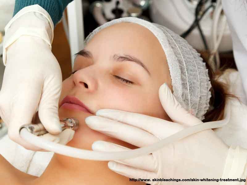 Home Remedies For Skin Bleaching: 6 StraightForward Organic Masks | by ...