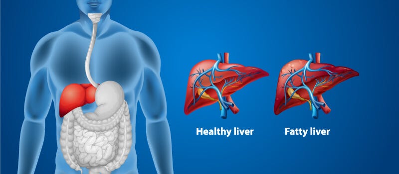 Oliver Liver Detox supplement. On the professional internet site, the ...