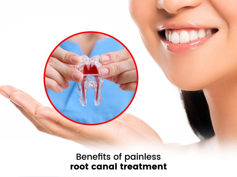 Benefits of Painless Root Canal Treatment | by Dr. Madhulika Purkait | Medium