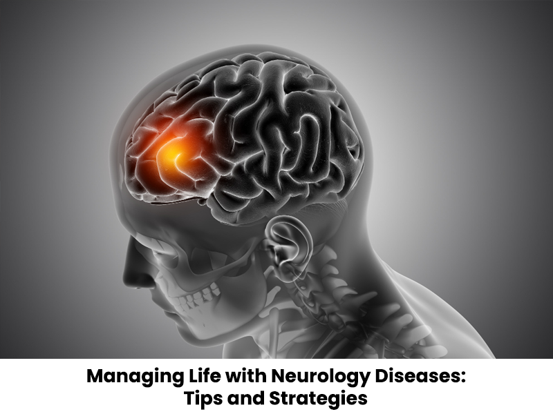 Managing Life with Neurology Diseases: Tips and Strategies | by kasturi ...