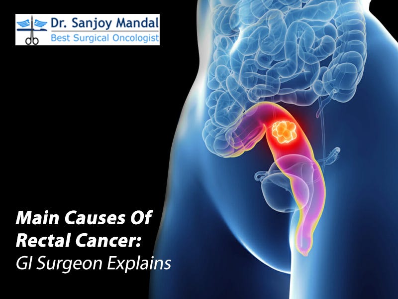 Main Causes Of Rectal Cancer: GI Surgeon Explains | by Rakesh ...