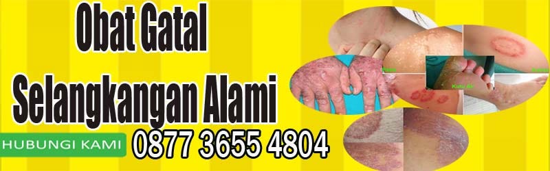 Pil Obat Gatal Selangkangan. Menderita penyakit Eksim /gatal tentu ...