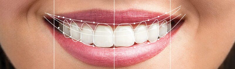 Why Choose a Smile Makeover? - Chaitanyakanna - Medium