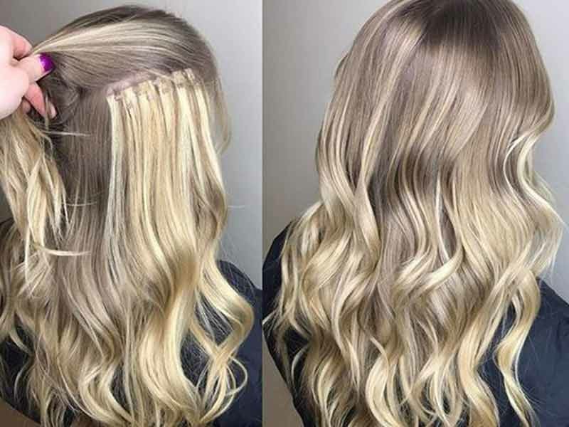 Hair Fixing in Jaipur — Non Surgical Hair Replacement ...