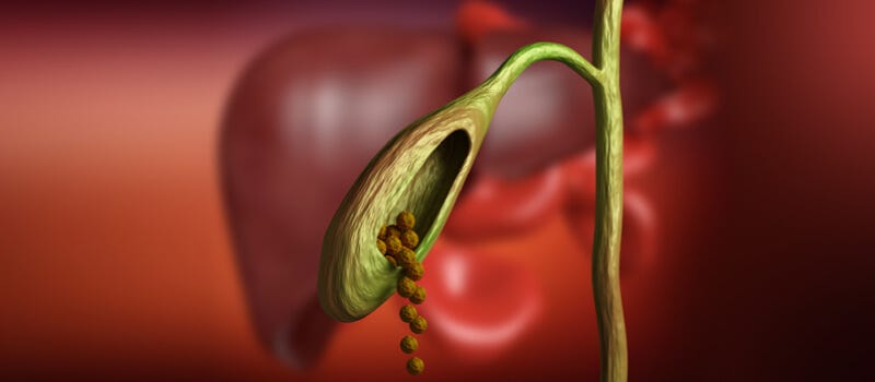 SAFETY AND EFFICACY OF EXTRACORPOREAL SHOCK WAVE LITHOTRIPSY FOR COMMON ...