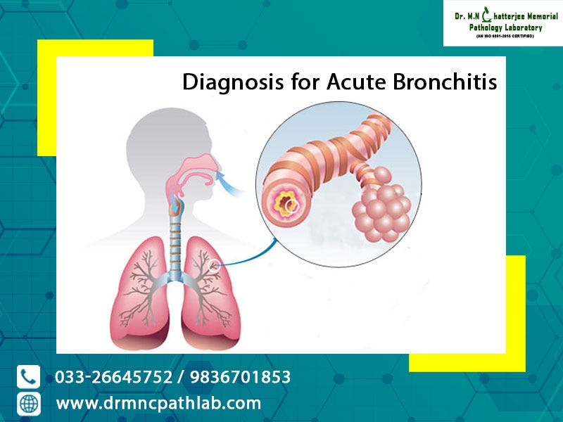 Diagnosis for Acute Bronchitis. When there is a sudden development of ...