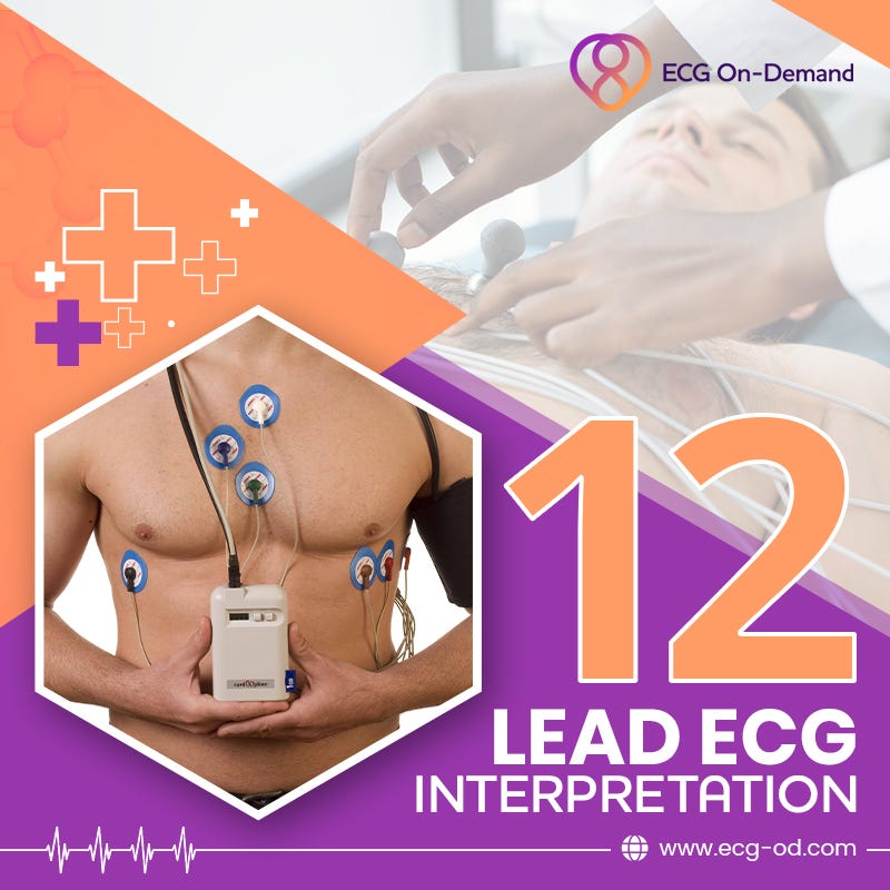 Ambulatory Holter Monitoring: What, Who, Why, And Beyond | by SEO Team | Medium