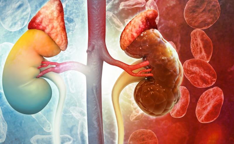 Acute Kidney Injury: Understanding the Causes and Symptoms | by ...