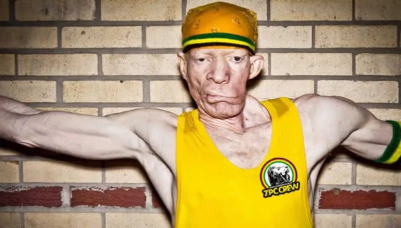 I am really admire fromYellow man | by DaviNder DhaliwAl | Medium