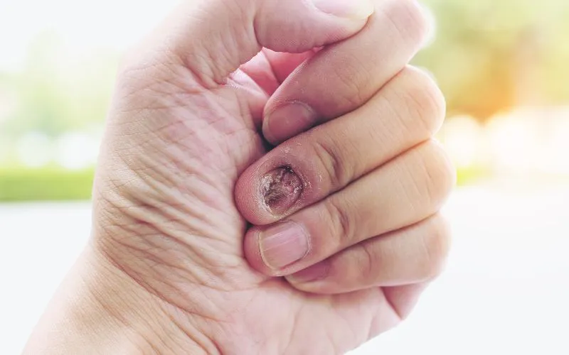 What are some common reasons for nails to become yellow and how to ...