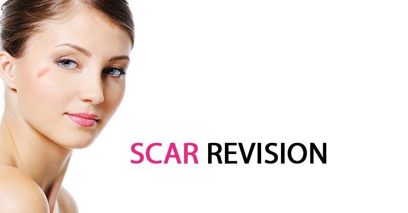 What is the procedure in Scar Revision Surgery? - Vivaaestheticclinic ...