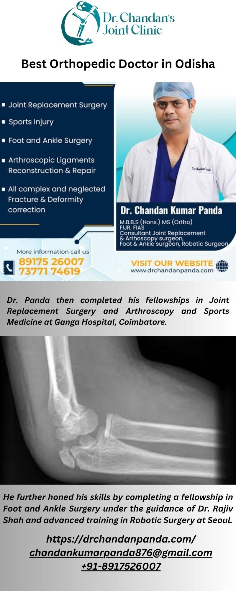 Experience Exceptional Orthopedic Care with Dr. Chandan Kumar Panda in ...