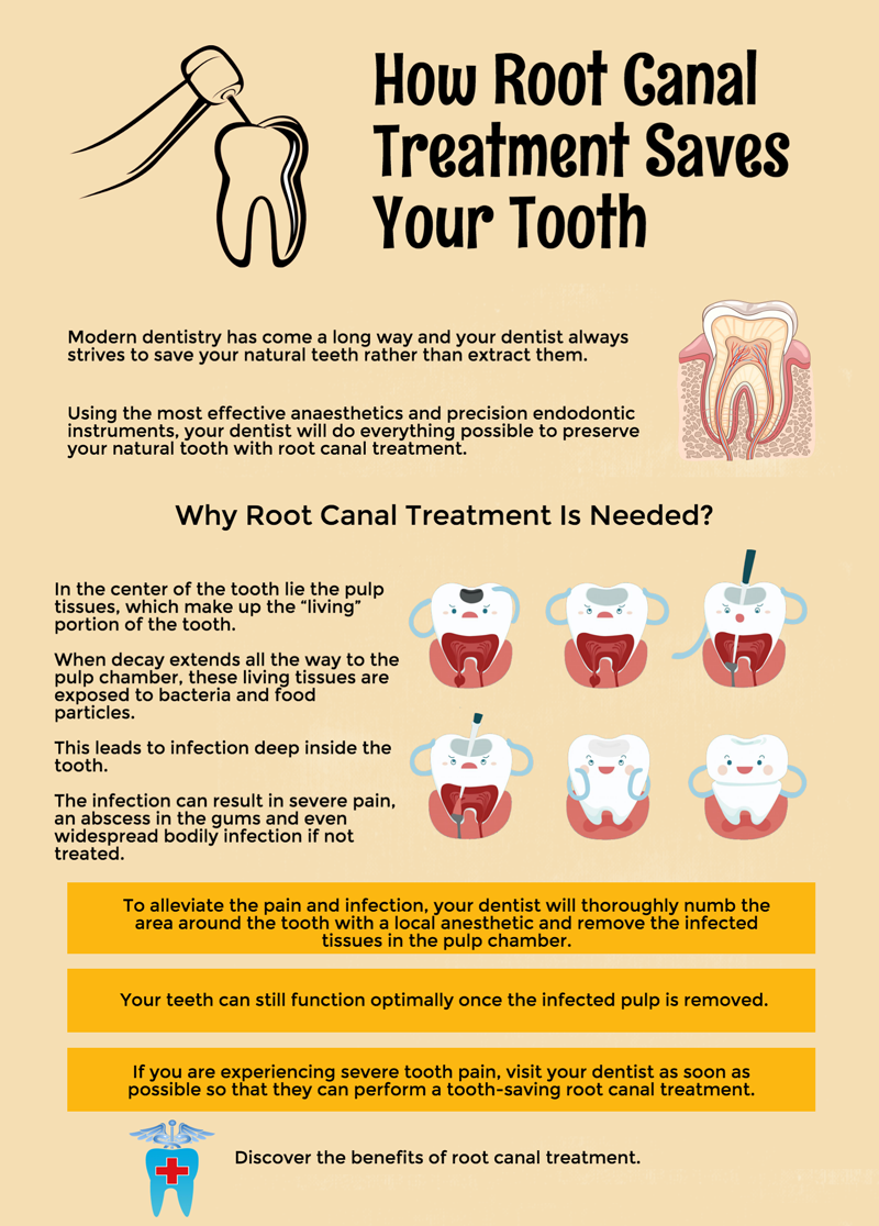 How Root Canal Treatment Saves Your Tooth - Greensborough Dental - Medium