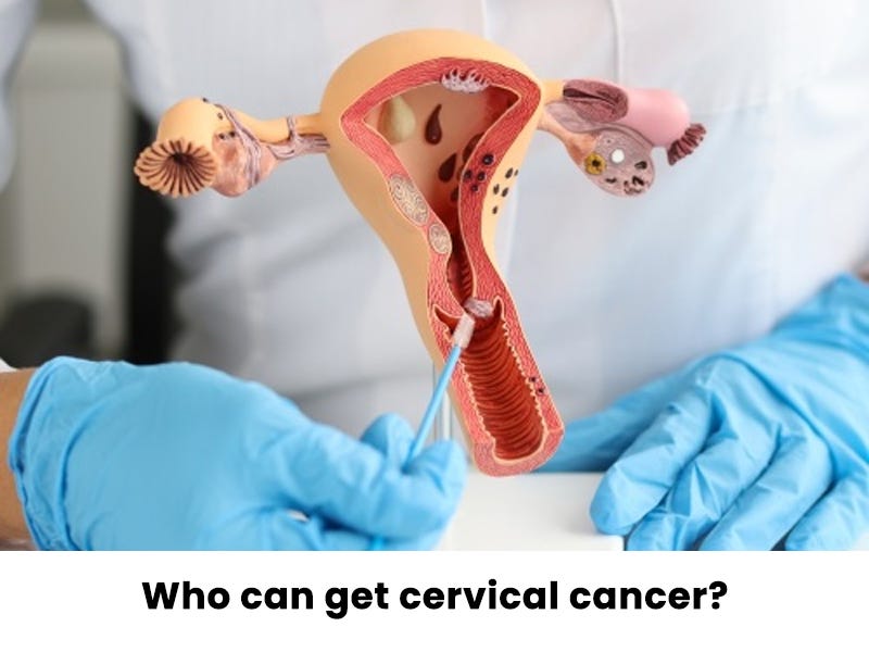 Who can get cervical cancer?. Many women suffer from cervical cancer ...
