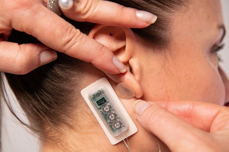 Neurostimulator Medical Device Market 2024: Comprehensive Study By Type ...