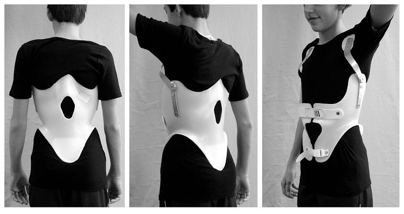 How Wearing a Brace Helps with Spinal Disorders | by newportorthopedic ...