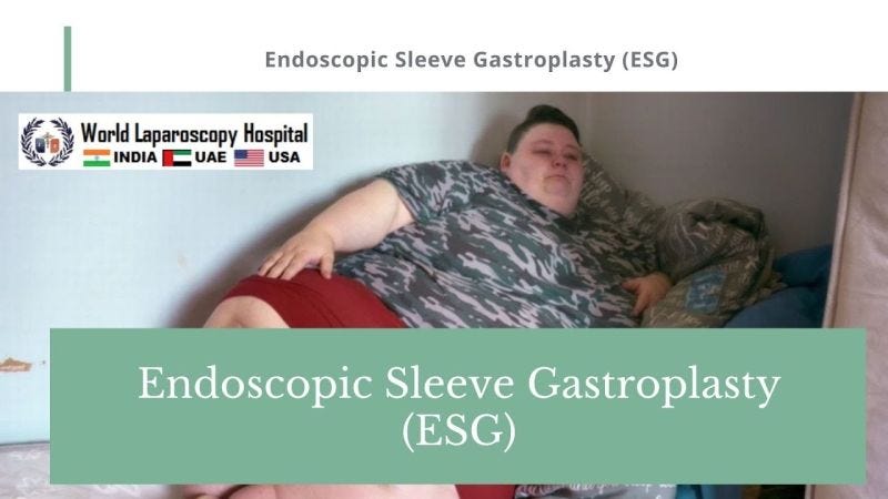 Endoscopic Sleeve Gastroplasty (ESG) | by laparoscopic hospital | Medium