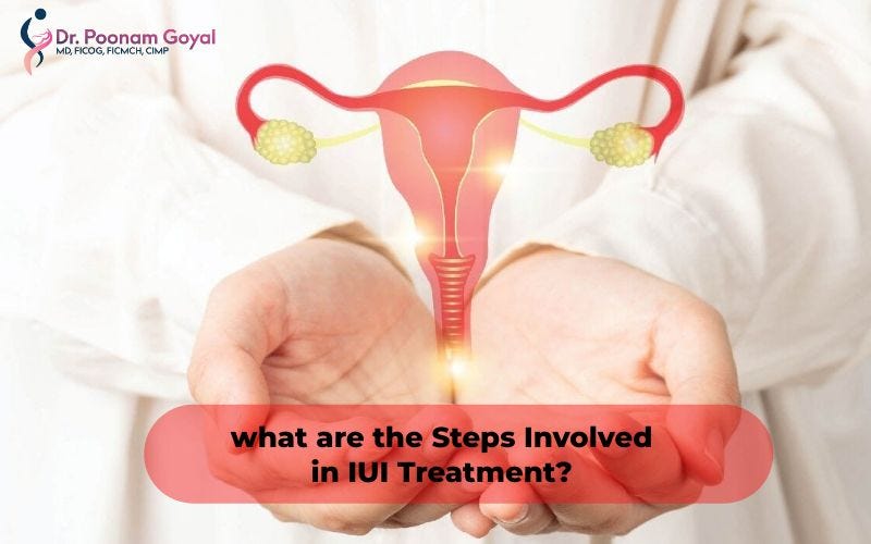 Understanding the Steps Involved in IUI Treatment | by Dr. Poonam Goyal ...