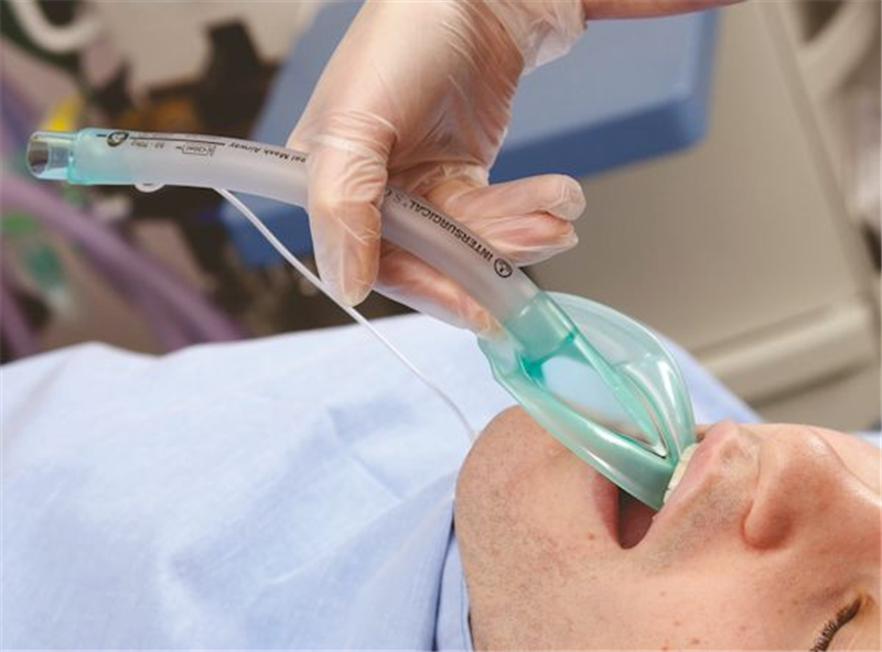 Emerging Trends Reshaping the Global Laryngeal Mask Market | by Sneha ...