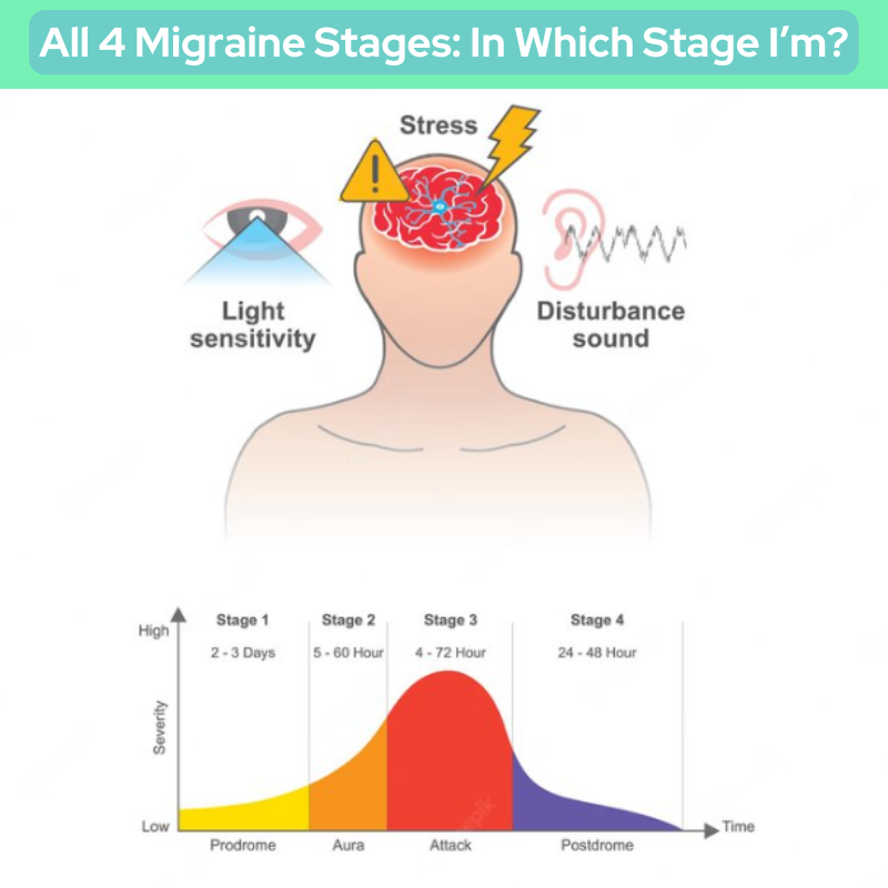 All 4 Migraine Stages: In Which Stage I’m? | by Acetaminophen ...