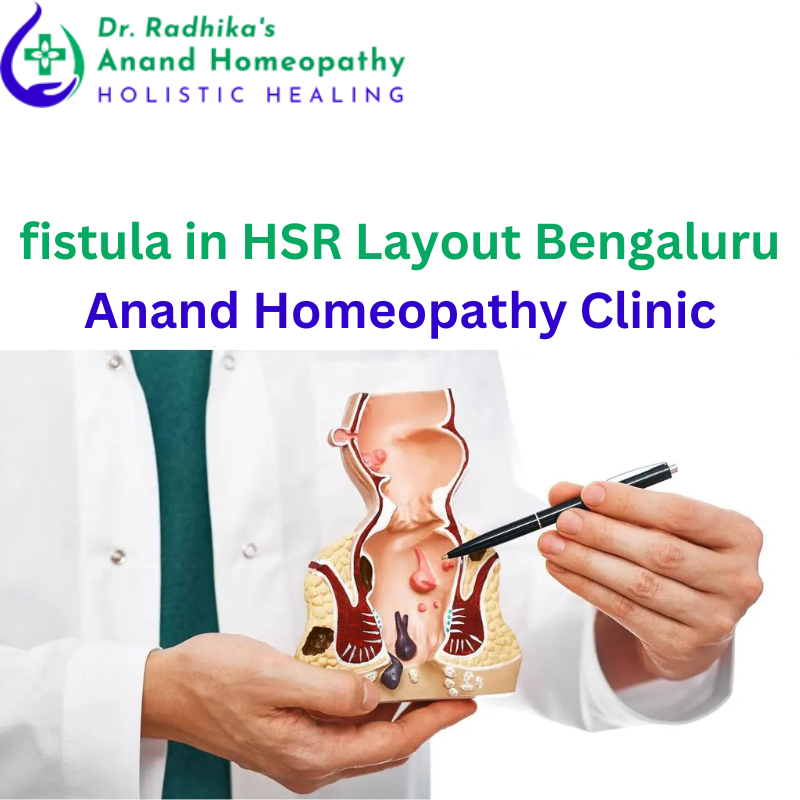 Best Fistula in HSR Layout Bengaluru -Anand Homeopathy Clinic | by Dr ...