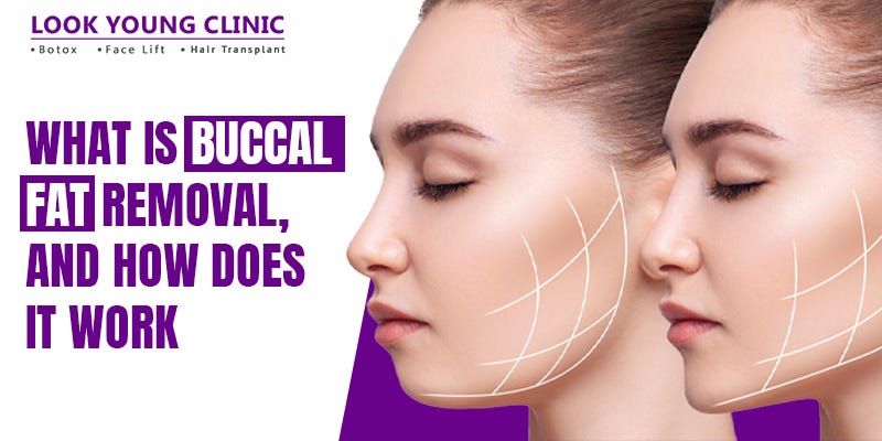 What Is Buccal Fat Removal, And How Does It Work? | by Look Young ...
