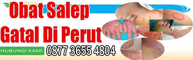 Obat Salep Gatal Di Perut. Menderita penyakit Eksim /gatal tentu… | by ...